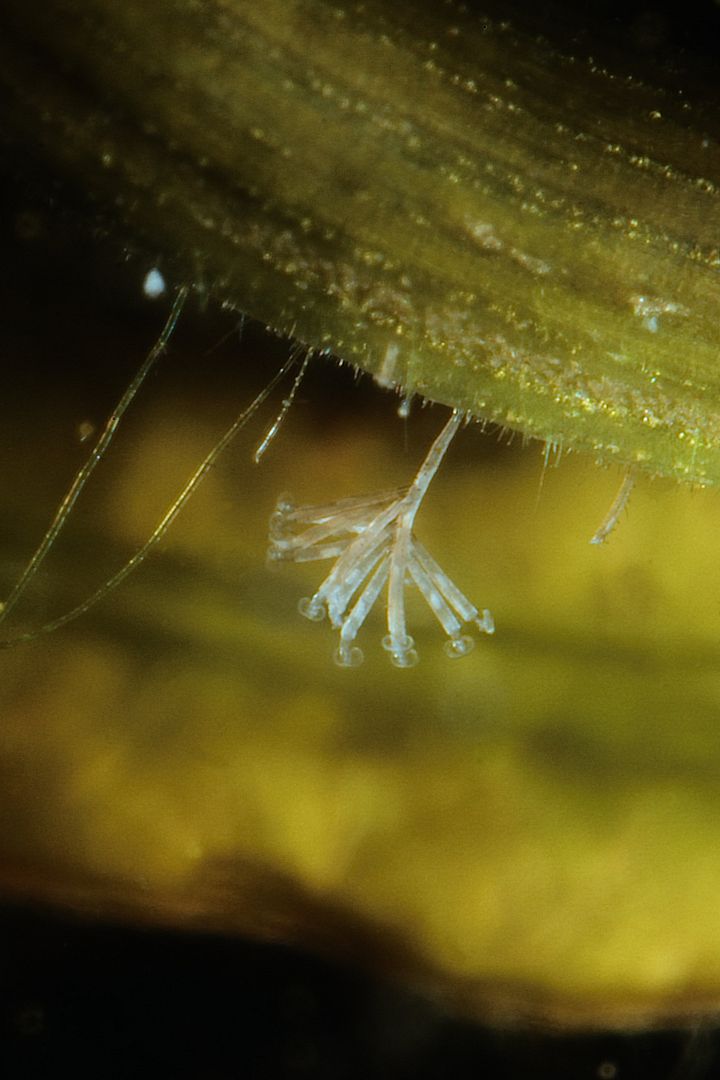 Sessile Loricate Rotifers - Cloudy Days & Microscopes - Cloudy Nights