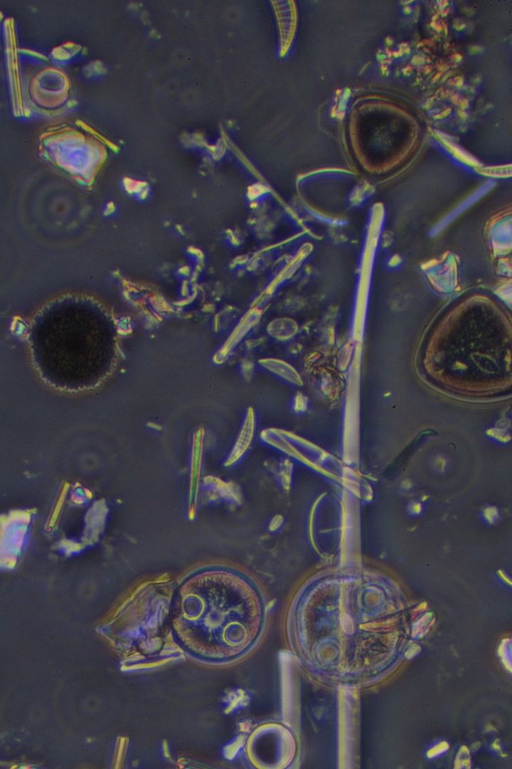 Preparing Diatom Strew Slides - Cloudy Days & Microscopes - Cloudy Nights