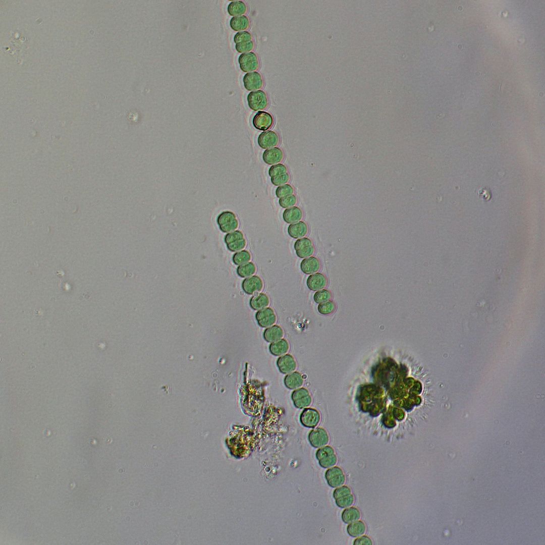 Desmids On My Mind - MicrobeHunter.com Microscopy Forum