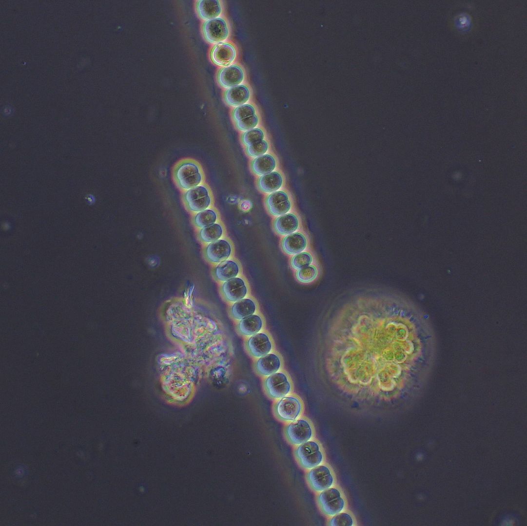 Desmids On My Mind - MicrobeHunter.com Microscopy Forum