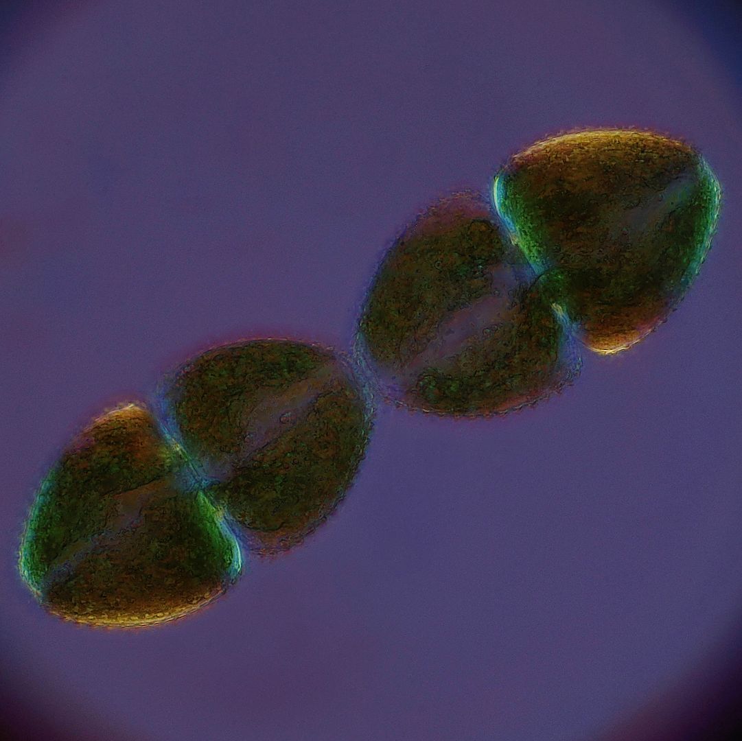 Delightful Desmids - Cloudy Days & Microscopes - Cloudy Nights
