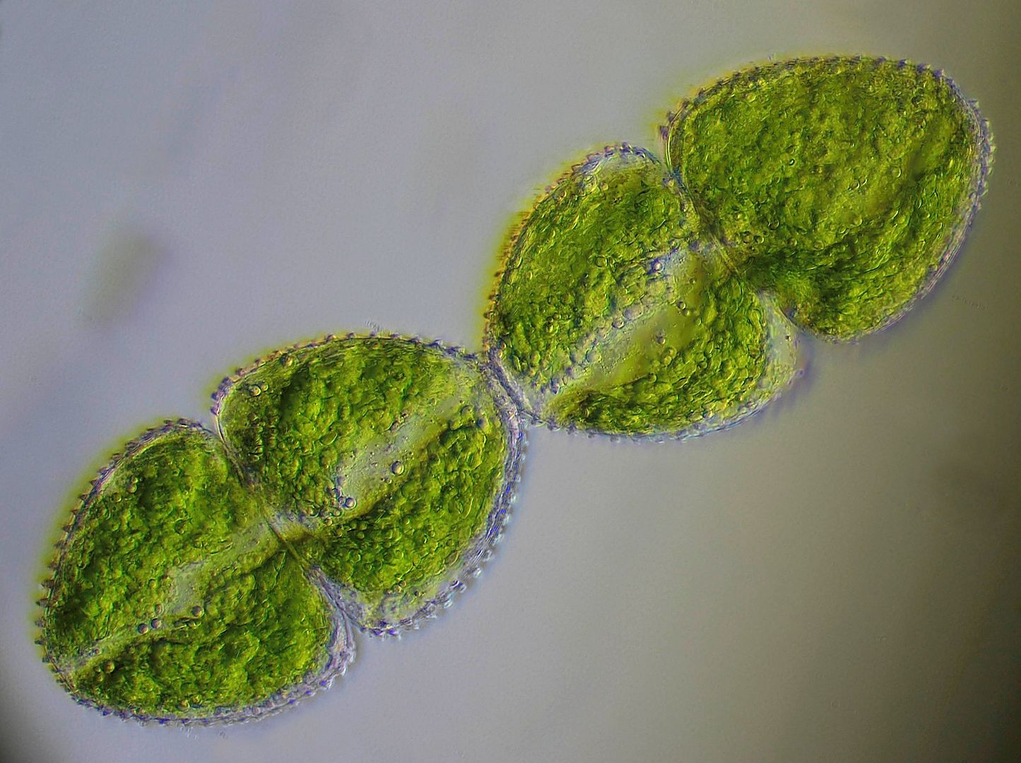 Delightful Desmids - Cloudy Days & Microscopes - Cloudy Nights